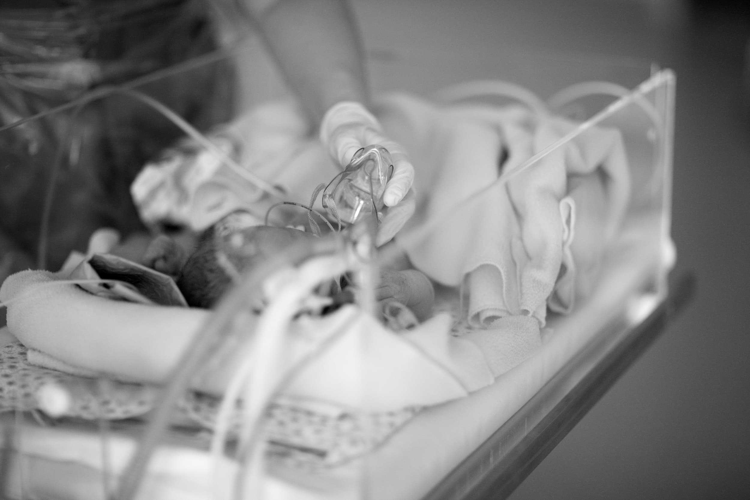 Parto prematuro: quais são as principais causas? - Maternidade D`Or