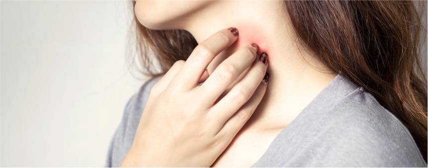 Furúnculo: O que é, sintomas, tratamentos e causas.